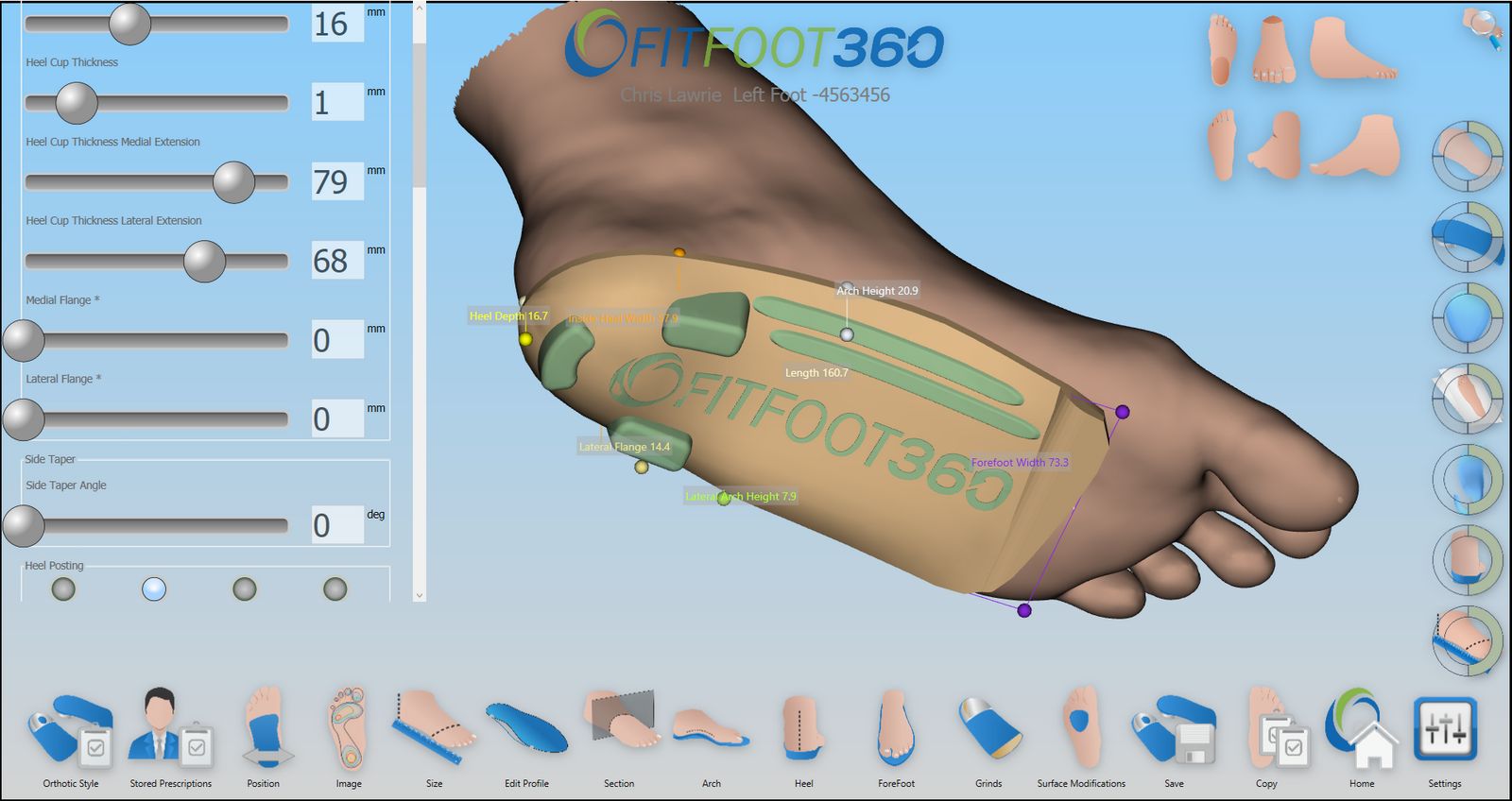 3D Printed Orthotic Insoles | FitPrint360