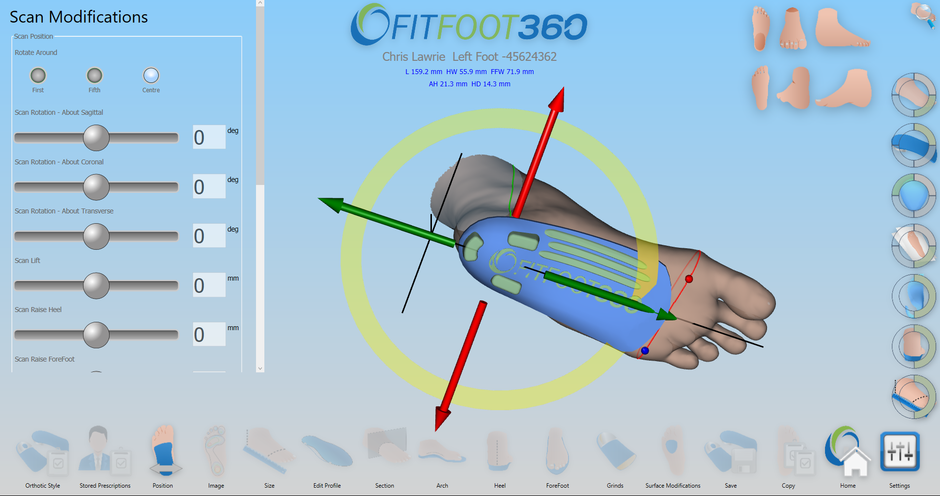 Custom Insole Design Software | FitFoot360
